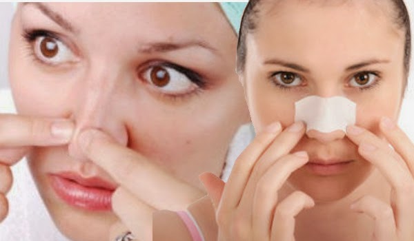 Cara Menghilangkan Komedo dan Cara Untuk Mencegahnya | Portal Teropong ...