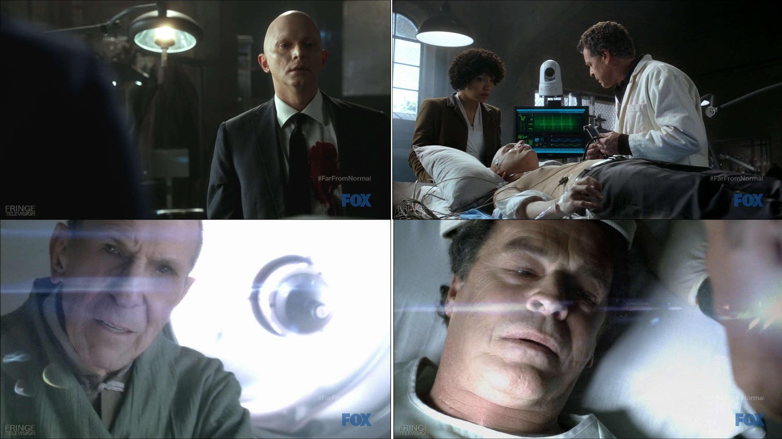 Fringe Observiews 5.10 Anomaly XB-6783746 ~ Fringe Television - Fan ...