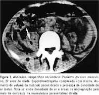 Flanco Esquerdo : 2016