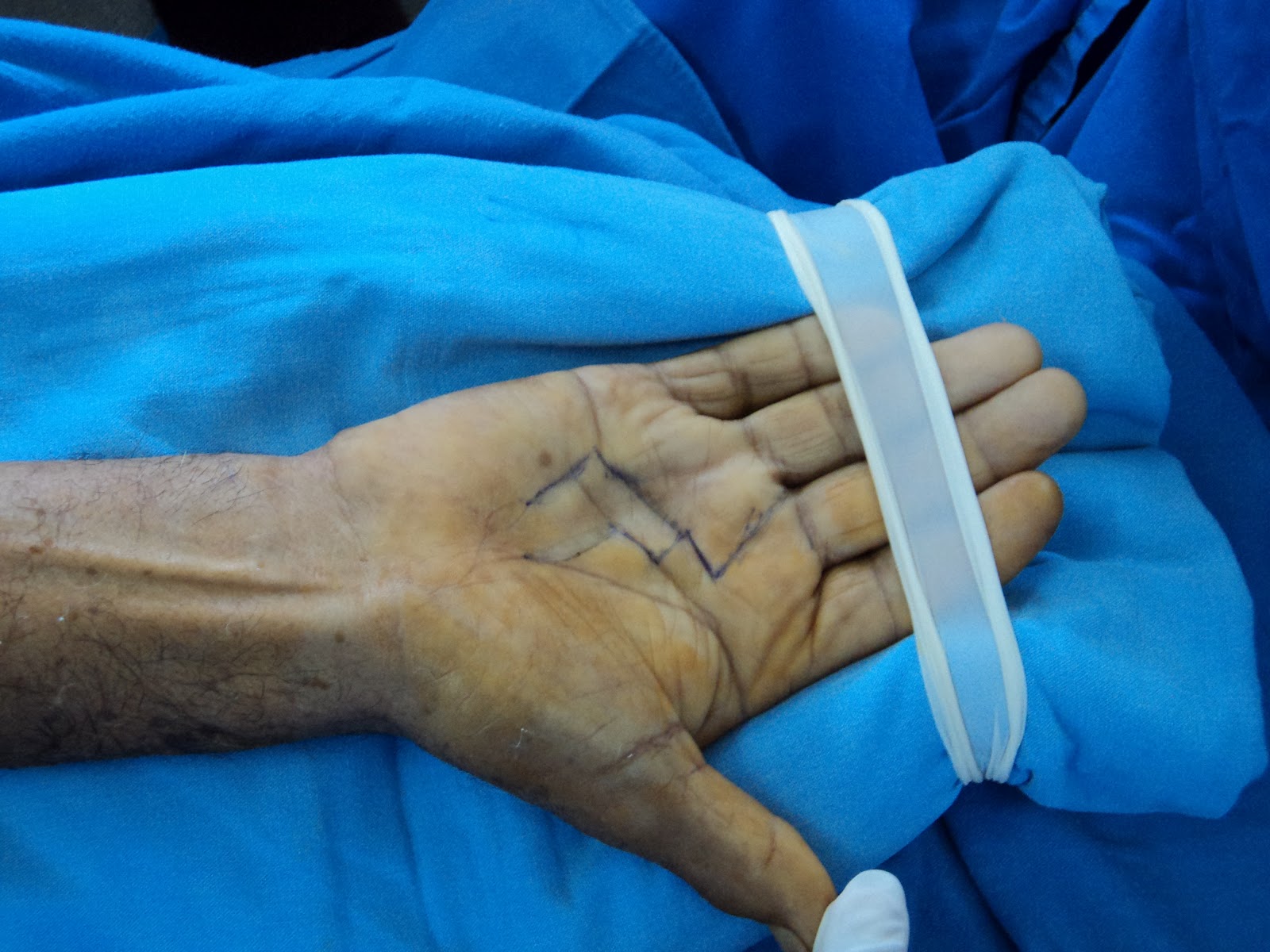 OSSA CARPALIA ©: 2012