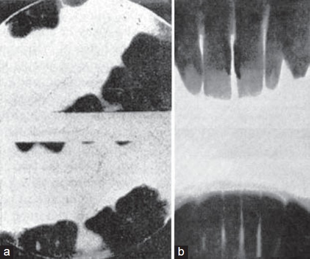 RADIOLOGÍA ESTOMATOLÓGICA: Historia de los rayos X