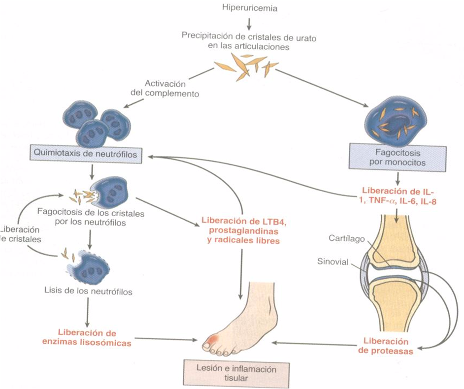 ARTROPATÍAS: GOTA