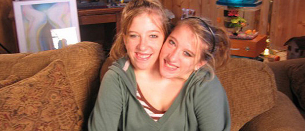 SABER MAS: ¿Qué pensará una siamesa cuando la otra anuncia que se casa?