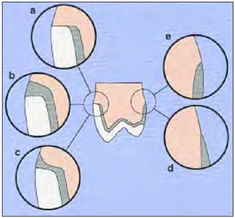 Dentistry lectures for MFDS/MJDF/NBDE/ORE: Principles of Tooth ...