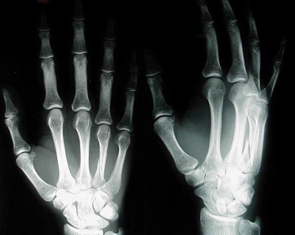 Separatas de Biofìsica 2: Los rayos Equis