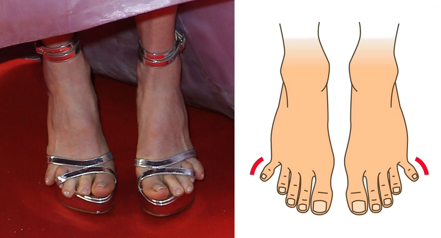 9 Foot Shapes That Reveal Secrets about Your Personality