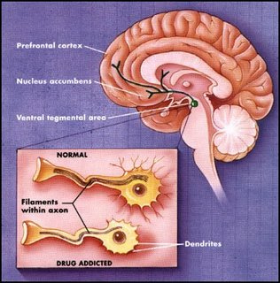 Drug Abuse and the Increase in HIV | Drug Addiction and Alcoholism