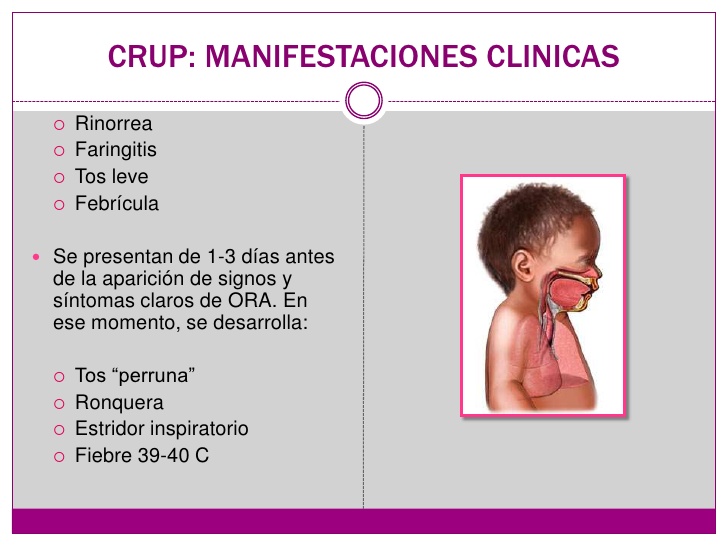 Evita así el crup, la tos nocturna del bebé - Neobaby