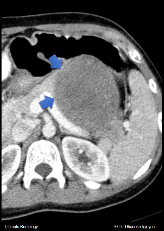 Ultimate Radiology : June 2017