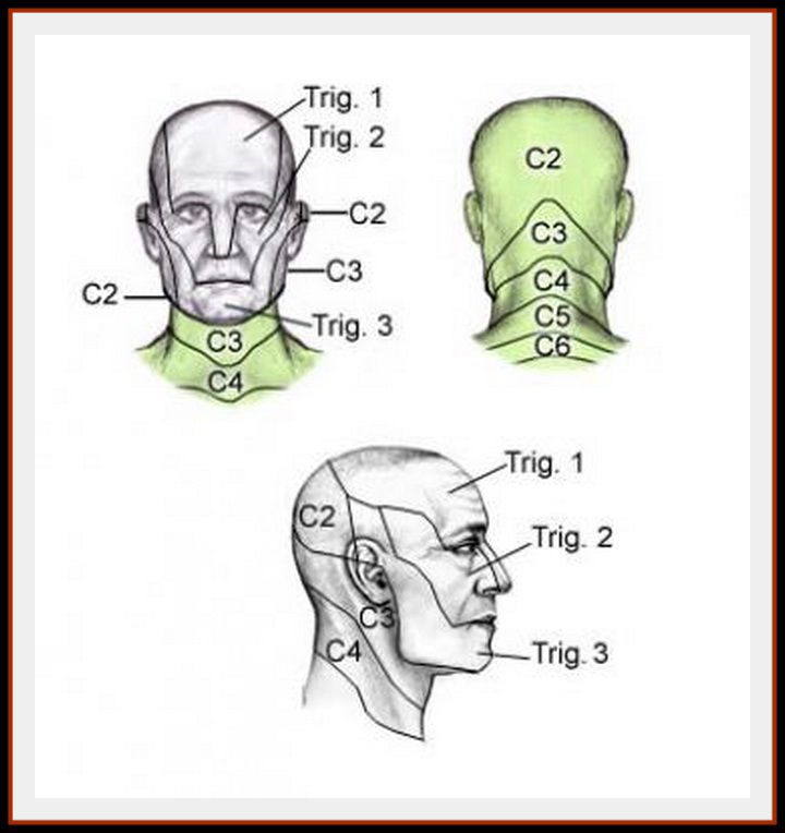 truthlady3: Dermatomes Dermal Segmentation