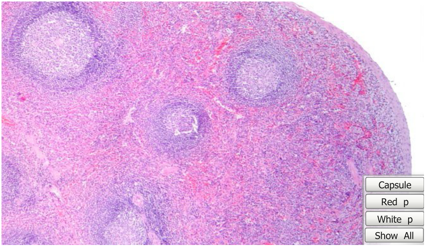 TP Histologie N° 2: la rate ~ TOP صحة