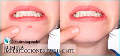 El Photoshopeador: Retocar imperfecciones en rostros