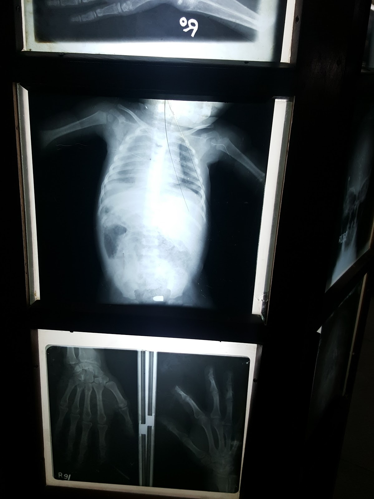 Forensic practical radiographs