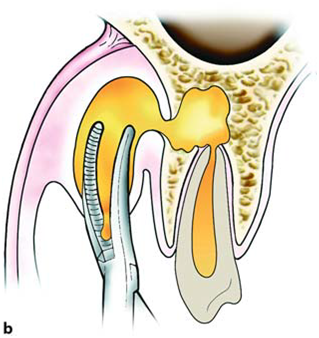 Dentistry and Medicine: Fundamental Principles of Treatment of ...