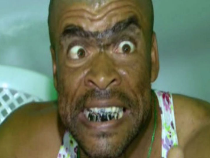 Mineiro é eleito o homem mais feio do Brasil ~ Sorriso FM