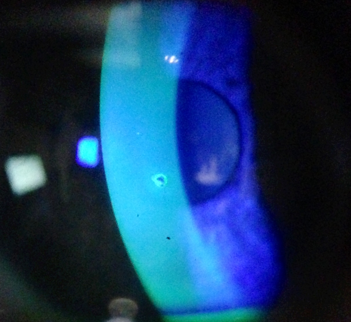 Hardly Housewives: EYE YI YI