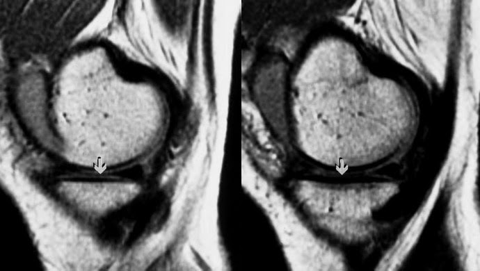 Ultimate Radiology : 'Semiology' - The Signs in Radiology
