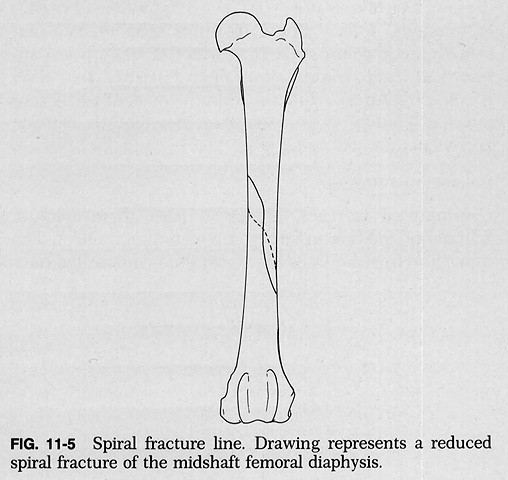 Prinsip Penanganan Patah Tulang (Fraktur) pada Hewan - Mydokterhewan