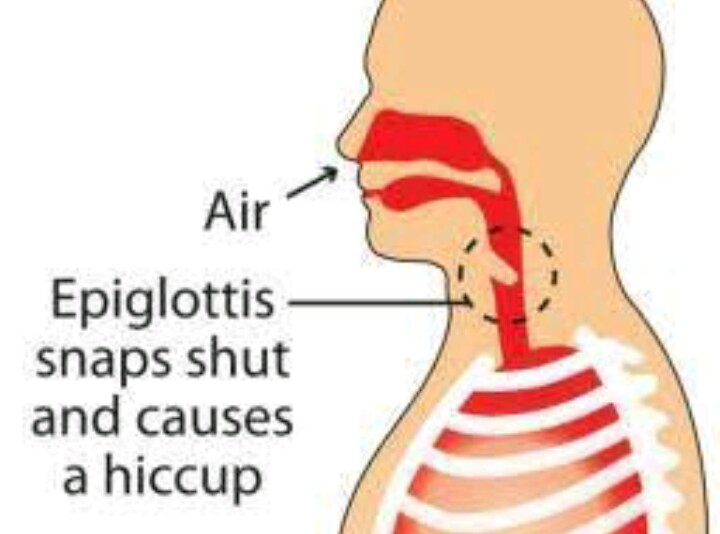 DaySpring Health Care: ADULT HICCUPS