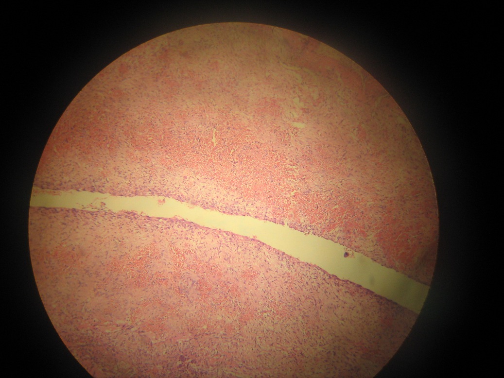 Dentistry and Medicine: Cysts in the mouth and jaws with histologic Slides