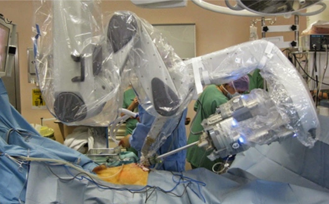 First clinical results of the da Vinci Sp Single Port device