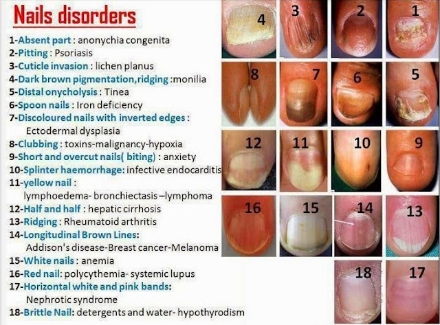 Here is an example of the correct 'cut' for your Finger or Toe-nails.