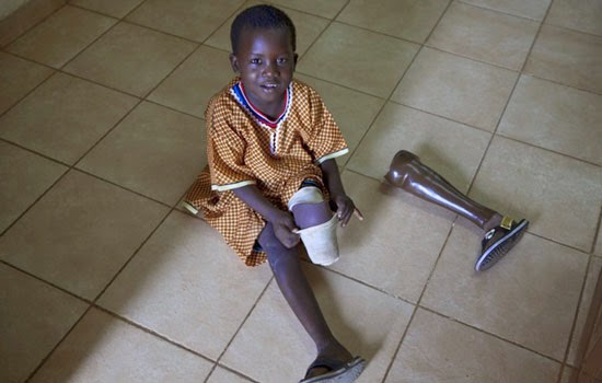 French Vocabulary Illustrated: moignon