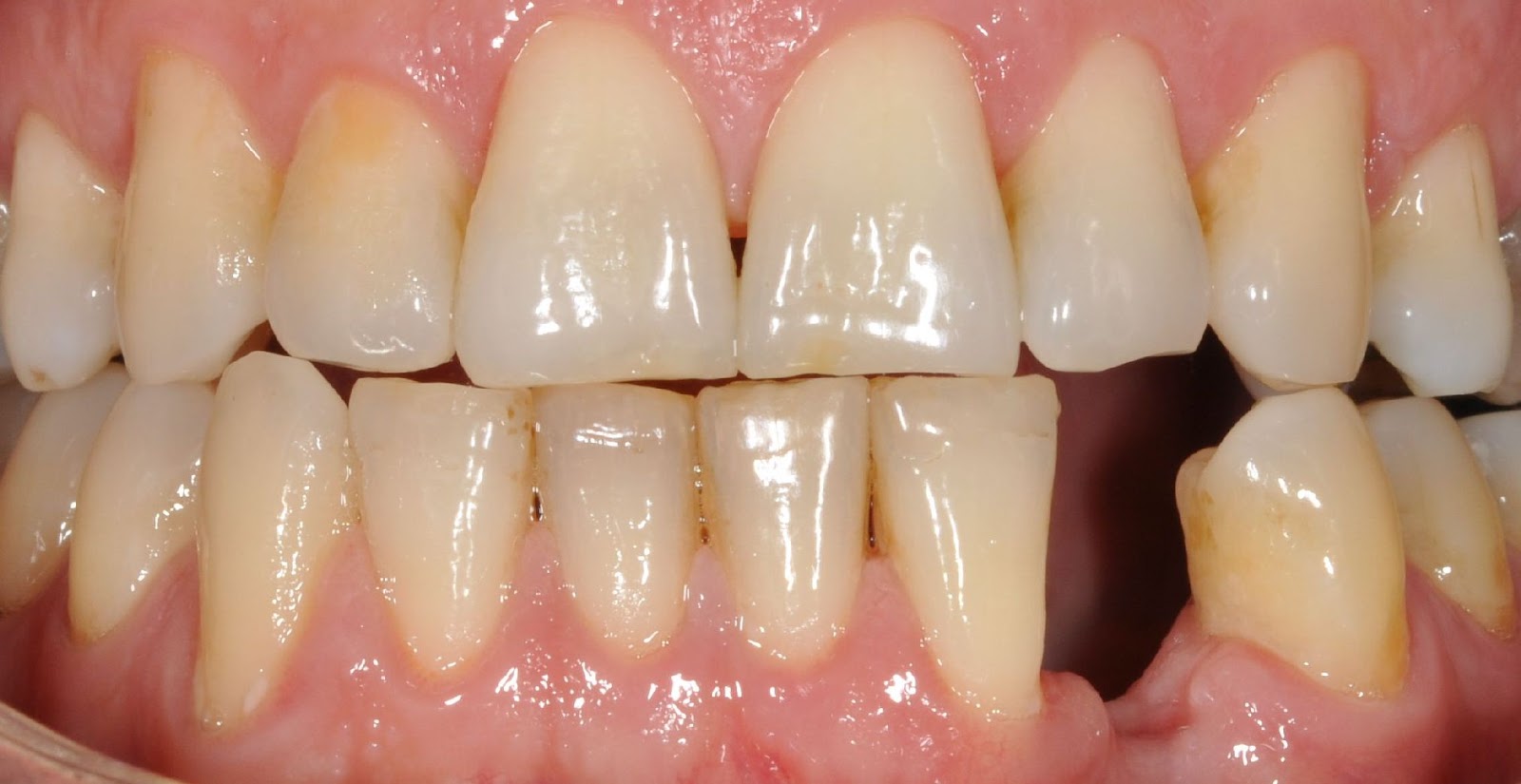 Milford Dentists Blog: 5 Before & After Photos that Show the Benefits ...