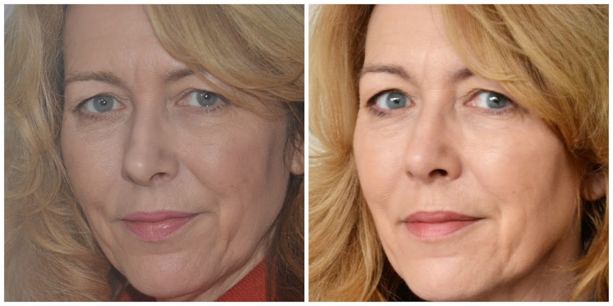 Slendertone Face - A Super Face Lifting Gadget – Laurie Bronze