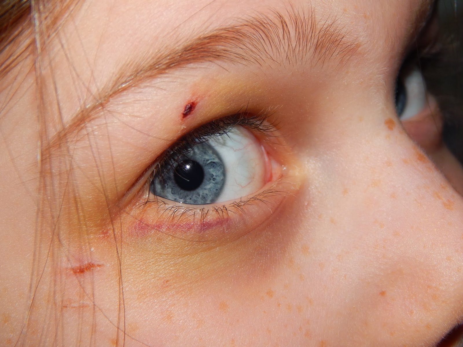 Call Me Irresponsible: The First Shiner Award goes to.....