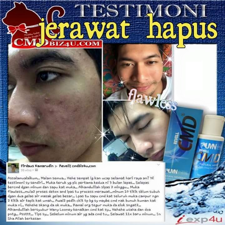 ♥Corat Coret Nusha ♥: Masalah resdung & muka licin hanya dengan ...