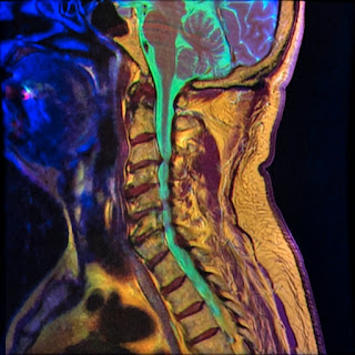 Nevit's blog: Color MRI of the Cervical verterbrae