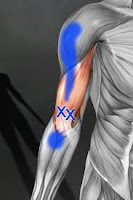 Are you missing shoulder extension ROM? - MobilizeMe Physiotherapy
