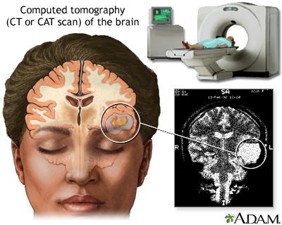 CT Scans: All You Need To Know: Advantages and Disadvantages involved ...