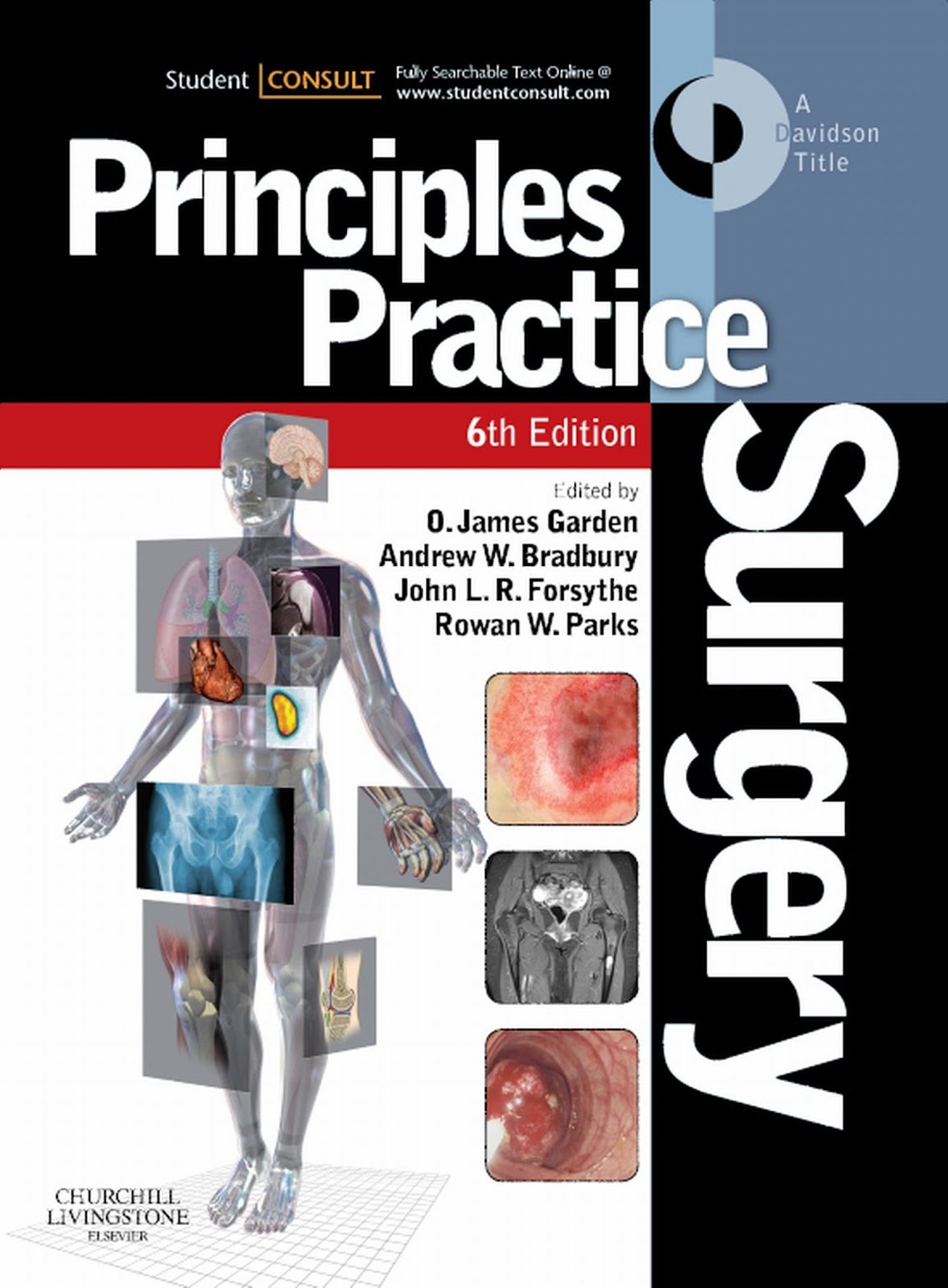 Principles and Practice of Surgery 6th Edition ~ Essentials of Human ...