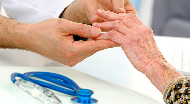 ¿Qué es la artritis reumatoide? - Antioxidantes y tu cuerpo