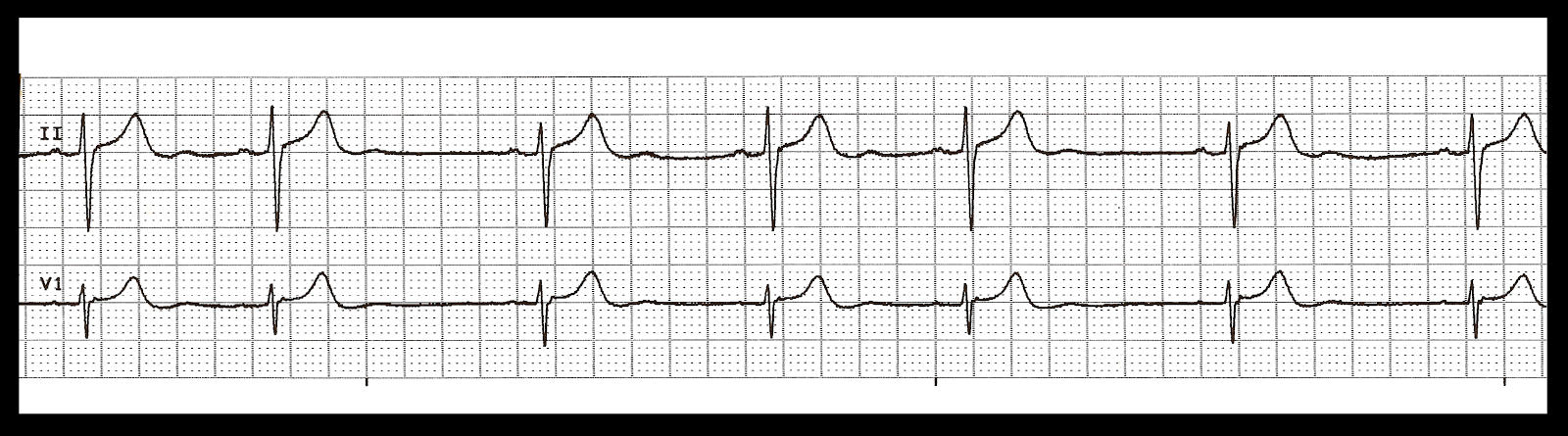 Practice EKG Strips 329
