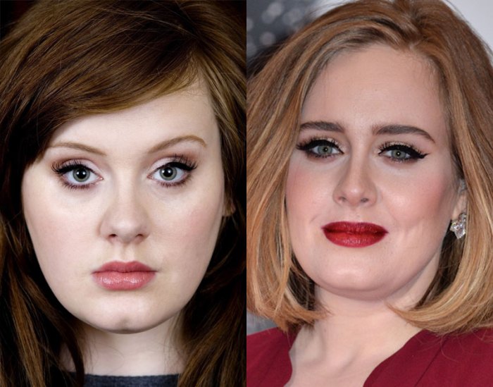 Adele Nose Job Controversy