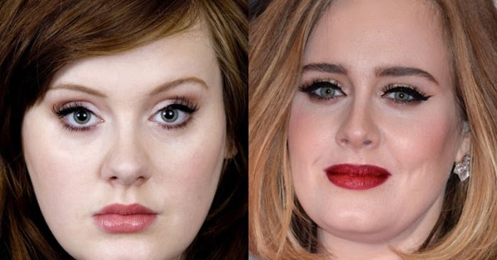 Does Adele Have a Nose Job? | Celebrity Surgery Before and After