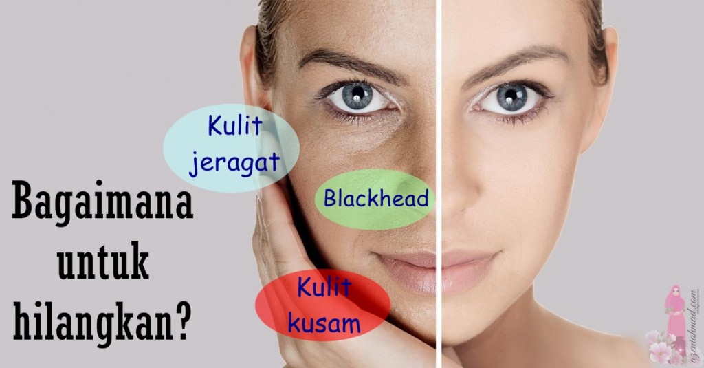 CARA HILANGKAN JERAGAT DENGAN CEPAT DAN SELAMAT - CUTE AND BEAUTY