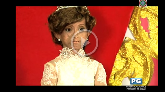 She's Expected to Live Only Until She's 16 Years Old due to a Rare ...