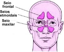 Sinusite: Conheça um pouco sobre ela!!! ~ Blog do Helton Carlos