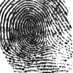 Modern & Multidimensional Iridology: Dermatoglyphics - An Assessment ...