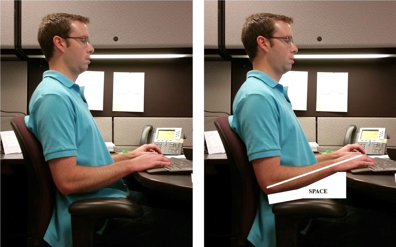 Dystonia Living: Tips to save your neck and back working on the computer