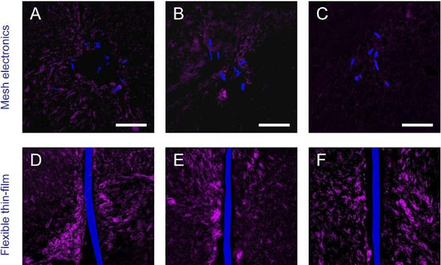 Our Parkinson's Place: Your brain on mesh: Injectable flexible probe ...