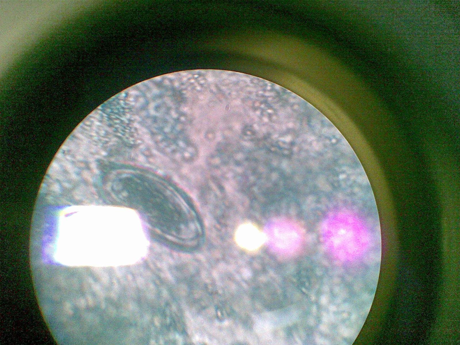 Ca - CaDo (Catatan Calon Dokter): Blok 9 : Praktikum Parasitologi ...