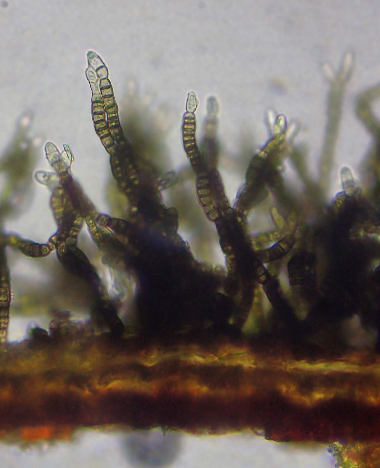 Myco Magic: Dematiaceous hyphomycetes