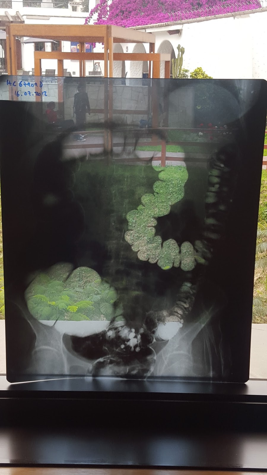 Introducción a la Radiologia: Radiografías con estudios especiales "Con ...