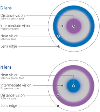 New OD's Guide to Multifocal Contact Lenses - Eyedolatry