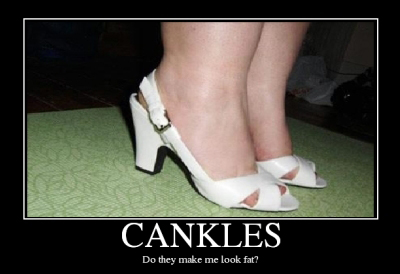 Two Little Pink Lines: Cankles - ahhhhhhh